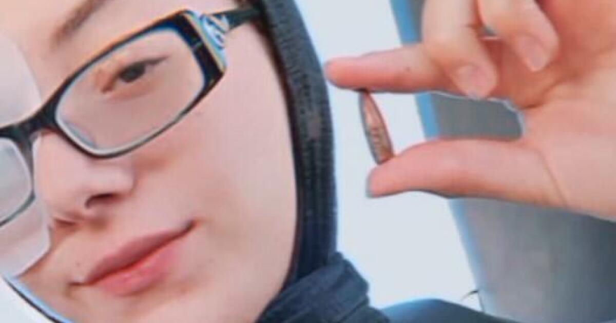 A Long Road to Recovery: Palestinian Woman's Bullet Removal After Four ...